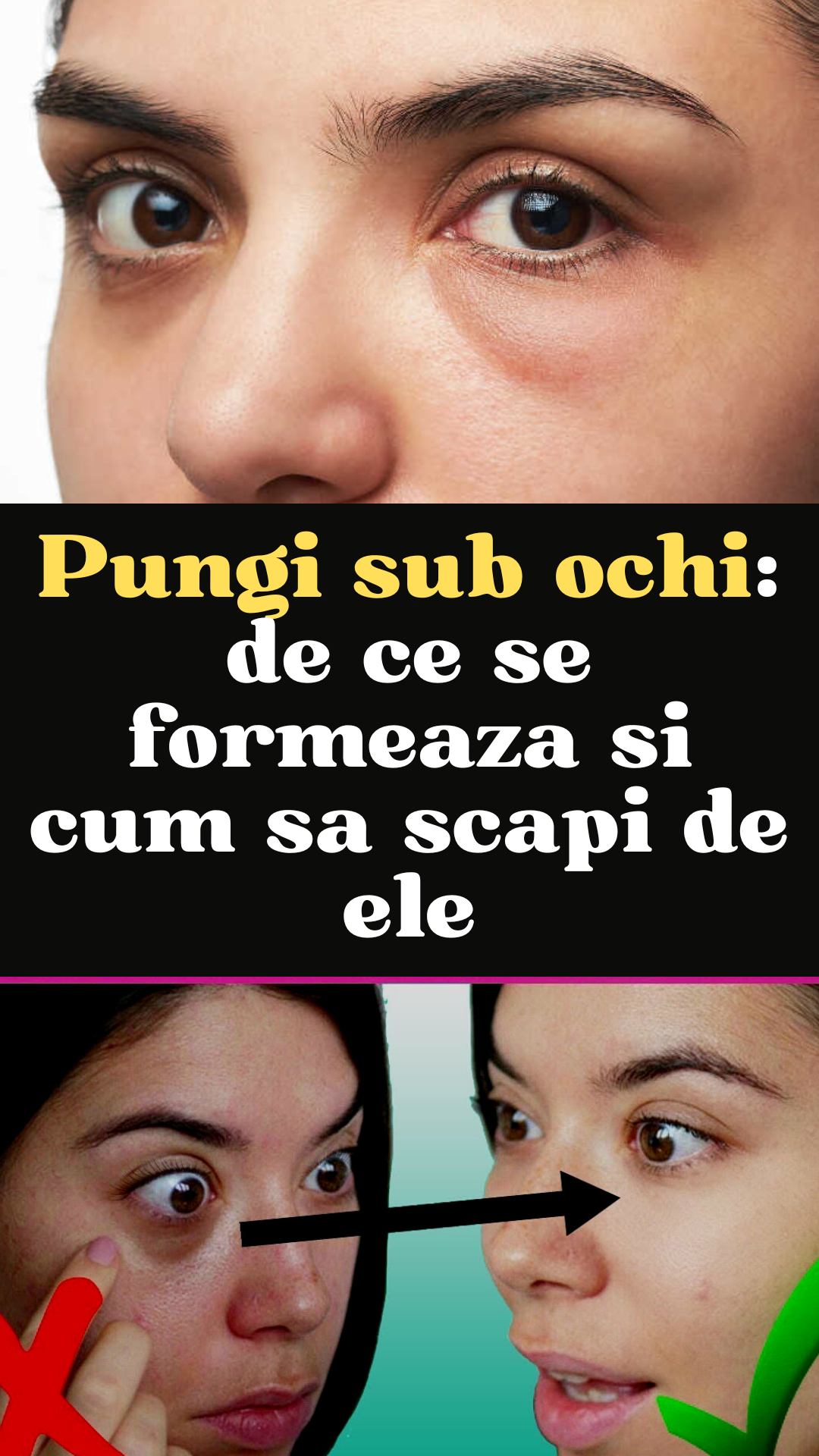 Pungi sub ochi: de ce se formează și cum să scapi de ele