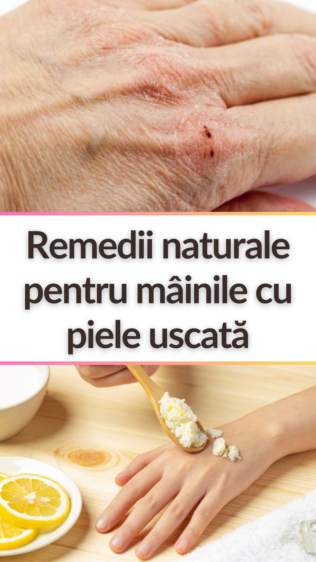 Remedii naturale pentru mâinile cu piele uscată