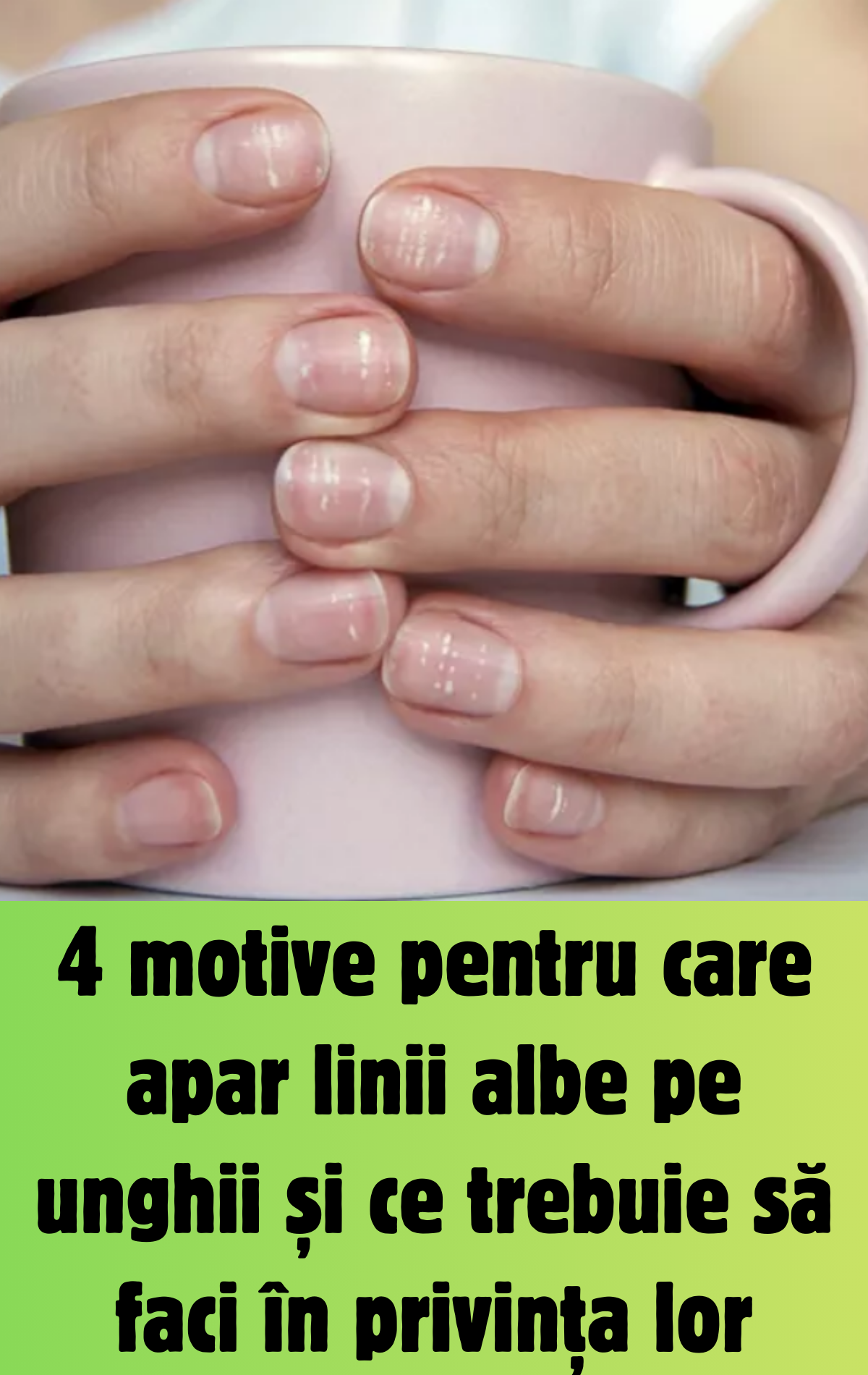 4 motive pentru care apar linii albe pe unghii și ce trebuie să faci în ...